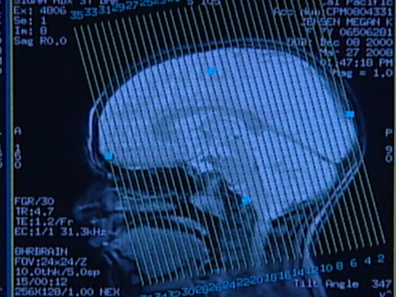 In the News: Proposed strategy to aging brain health | Evelyn F ...